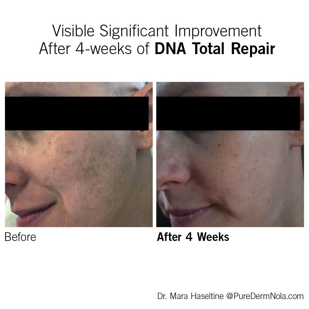 DNA Total Repair | NEOVA® SmartSkincare