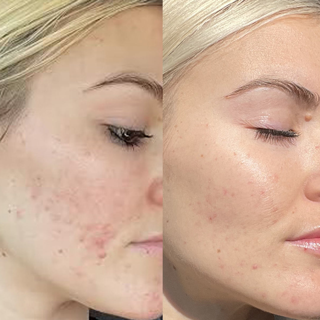 Multi-Active Day Cream | NEOVA